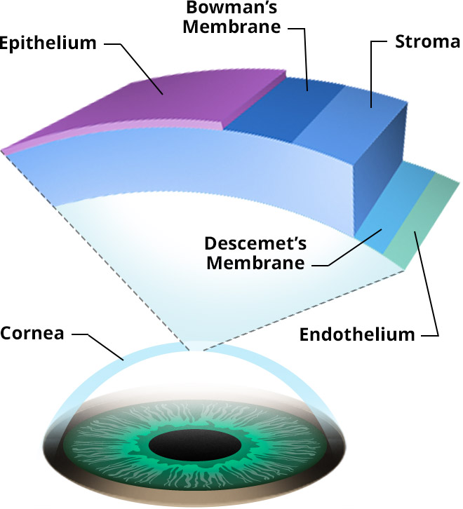Cornea Transplants | Cataract, Laser & Corneal Surgeon